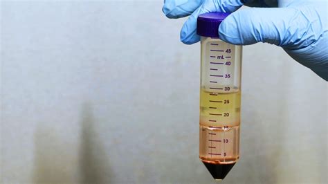 Sepmate™ 50 Ivd Tubes For Density Gradient Centrifugation Stemcell Technologies