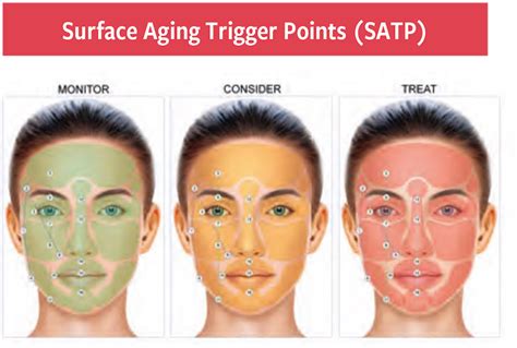 Aging Trigger Points Alterserscheinungen Präventiv Behandeln Mdm