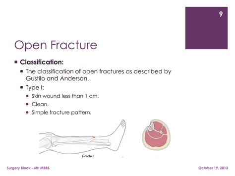 Open Fractures Pptx