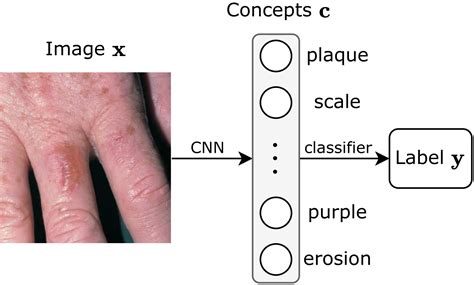 Evidential Concept Embedding Models Towards Reliable Concept