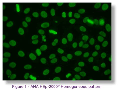 Immuno Concepts Technical Bulletin Reporting Homogeneous And Speckled Ana Patterns Abacus Dx