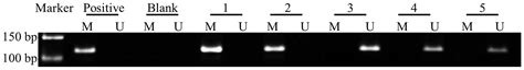 runx3 is inactivated by promoter hypermethylation in malignant