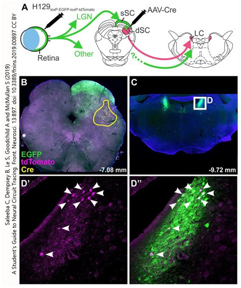 Axonal Transport And The Tracing Of Connections In The Brain