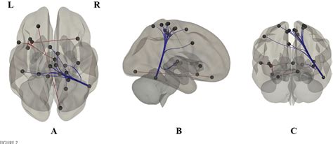 Figure 1 From Diagnostic Model Optimization Method For Adhd Based On Brain Network Analysis Of
