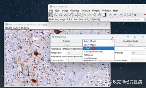 一文讲清免疫组化结果到底该选择阳性面积占比，平均光密度值，累积光密度值还是其他分析方法——imagej 知乎