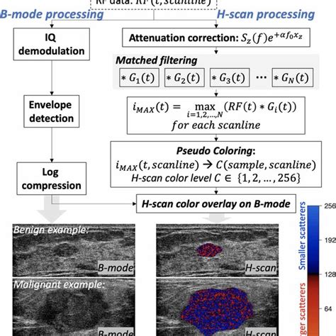 H Scan Processing And Example Results Of Benign And Malignant Cases