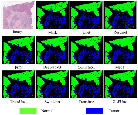 Attention Based Two Branch Hybrid Fusion Network For Medical Image Segmentation