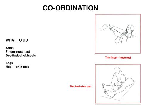 Cerebellum Function Tests
