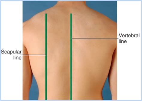Scapular Line