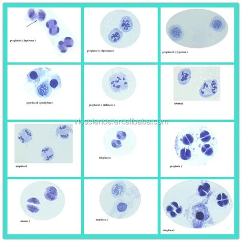 Anaphase 1 Of Meiosis Under Microscope Micropedia