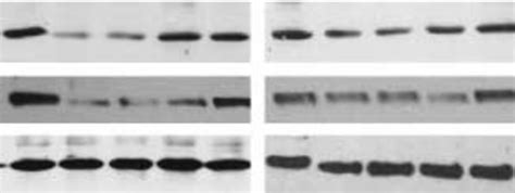 Dnmt Activity A And Expression Of Dnmt1 Dnmt3a And Dnmt3b B
