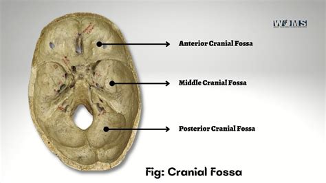 Cranial Fossa Contents Anatomy And Clinical Significance Woms