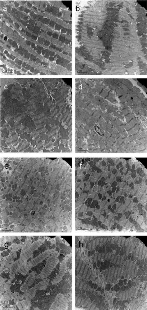 Transmission Electron Microscopy Of En And Ep Of 3 Mo Old Control