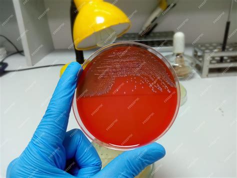 Croissance De La Culture Bactérienne Sur Plaque De Milieu Sélectif Dans