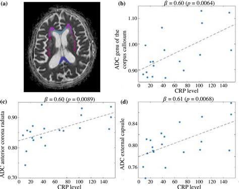 Association Between Systemic Inflammation And White Matter Download Scientific Diagram