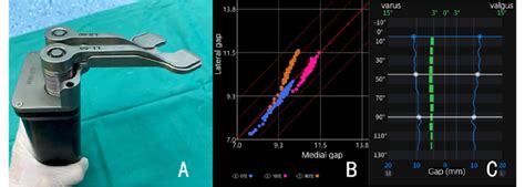 Smart Tools For Gap Balancing And Kinematics A Soft Tissue Balancing