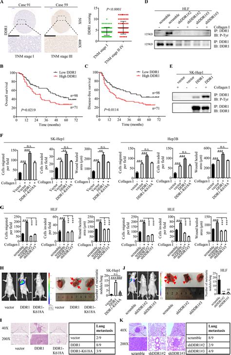DDR1 Plays A Prometastatic Role In HCC In Vitro And In Vivo A Download Scientific Diagram