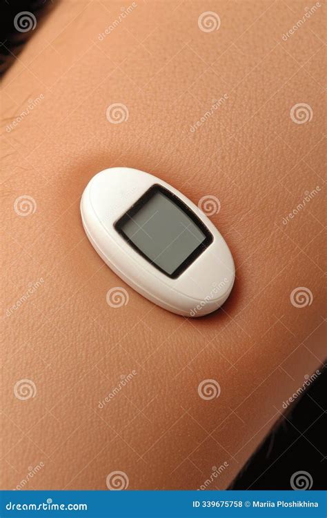 Continuous Glucose Monitoring Sensor On Skin For Diabetes Management
