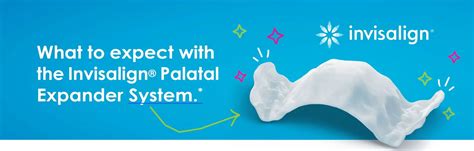 Invisalign Palatal Expander System Orthodontix