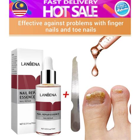 100% ORIGINAL LANBENA Nail Repair Essence Oils Serum Fungal Nail ...