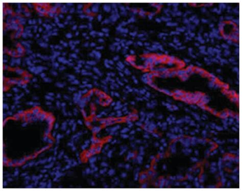 Oval Cell Marker Mab
