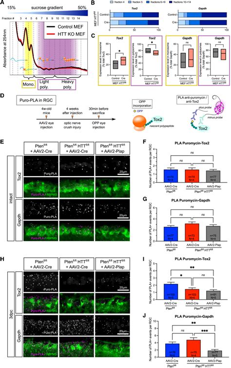 Customization Of The Translational Complex Regulates Mrna Specific Translation To Control Cns