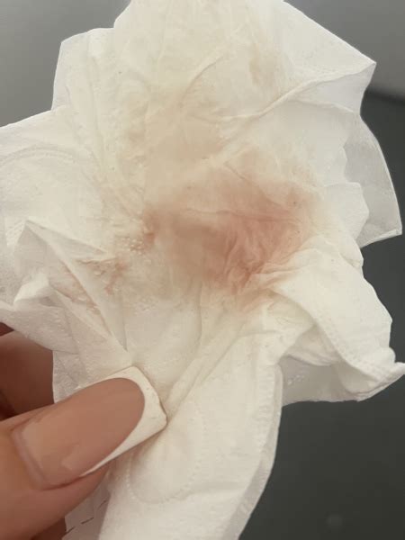 Potential Miscarriage With Bleeding 6 Weeks Mumsnet