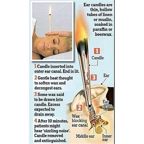 Use A Candle To Remove Ear Wax At Michael Woodard Blog