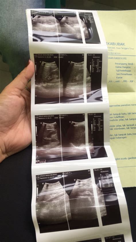 Hasil Usg HelloSehat