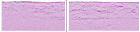 Southeast Lachlan Deep Crustal Seismic Reflection Survey Resources