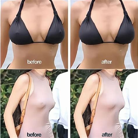 Boob Tapes For Women At ₹ 70 Meter Elastic Tapes In Surat Id