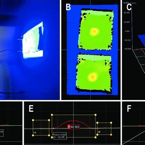 Image Of The Three Dimensional 3d Scanner And Cross Section Of The