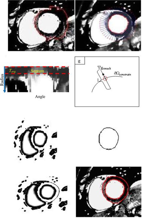 a detected epicardial boundary without constraint b radial line