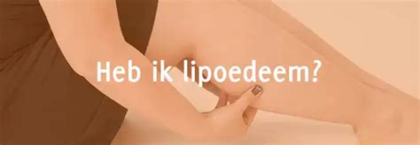 Wat Is Het Verschil Tussen Lipoedeem En Lymfoedeem Polikliniek De Blaak