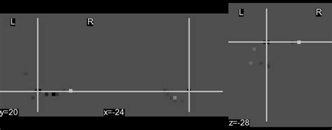Load And Plot Nifti File — Supereeg 021 Documentation