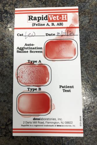 Lecture 26 Hypersensitivity Type Ii Iii Iv Flashcards Quizlet