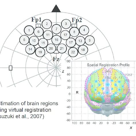 Probe Set And Location On The Brain Download Scientific Diagram