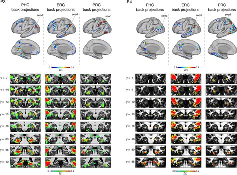Dissociating Distinct Cortical Networks Associated With Subregions Of