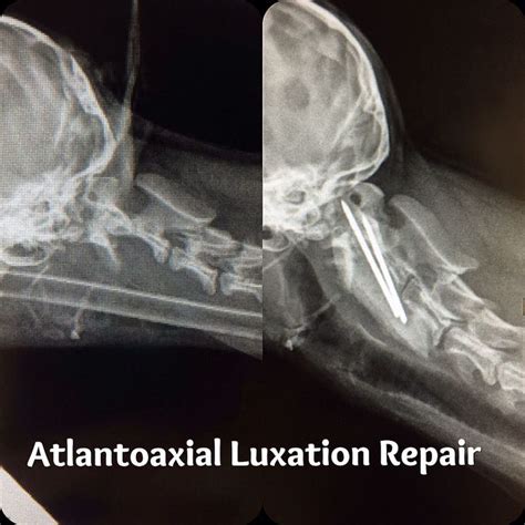 Atlantoaxial Luxation Repair Repair X Ray Veterinary Surgery