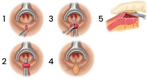 Best Anal Fissure Surgery Doctors In Faridabad