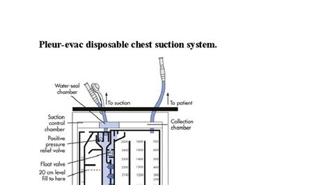 Pleur Evac Disposable Chest Suction System Setup Guide Studocu