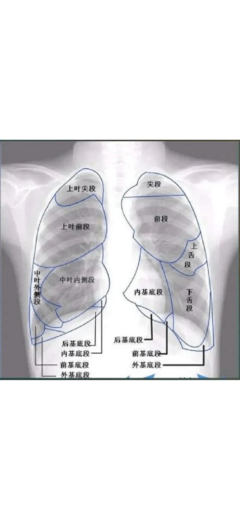 学习胸片（一、肺解剖 描述）