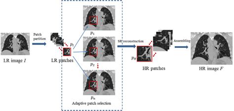 Overview Of Our Adaptive Patch Based Method For Super Resolution