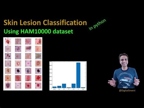Free Video Skin Cancer Lesion Classification Using The Ham10000 Dataset From Digitalsreeni