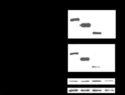figure s1 expression of runx1 constructs 293t cells were transiently