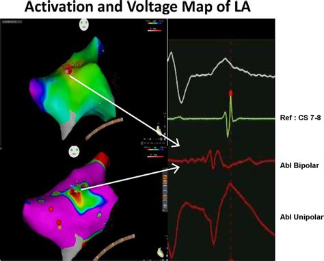 Activation Upper Left And Voltage Bottom Left Map Of The Left Download Scientific Diagram