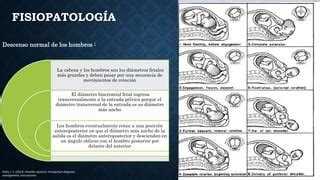 Distocia De Hombros En Ginecologia Y Obstetricia Pptx