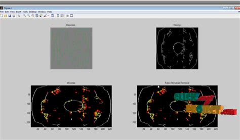 Efficient Multimodal Biometric Authentication Using Fast Fingerprint Verification And Enhanced