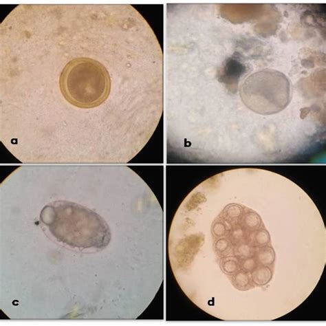 Eggs Of Toxocara Canis And Toxascaris Leonina A T Canis Bar 80 Download Scientific