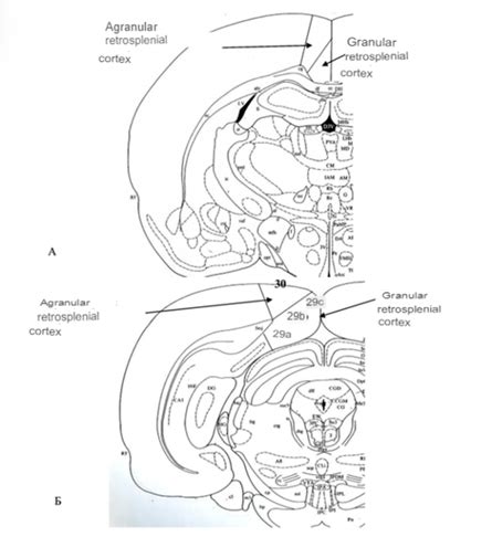 Retrosplenial And Cingulate Cortex Of The Rat Brain Cyto And Chemoarchitectonics Clinicsearch